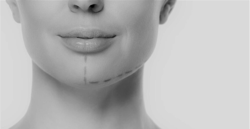 ΕΝΕΣΙΜΗ ΠΩΓΩΝΟΠΛΑΣΤΙΚΗ - CSC Clinic