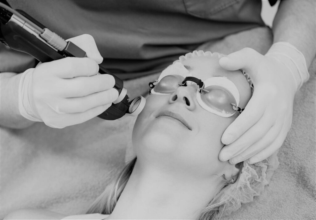 ΑΠΟΤΡΙΧΩΣΗ ΜΕ LASER ALEXANDRITE - CSC Clinic